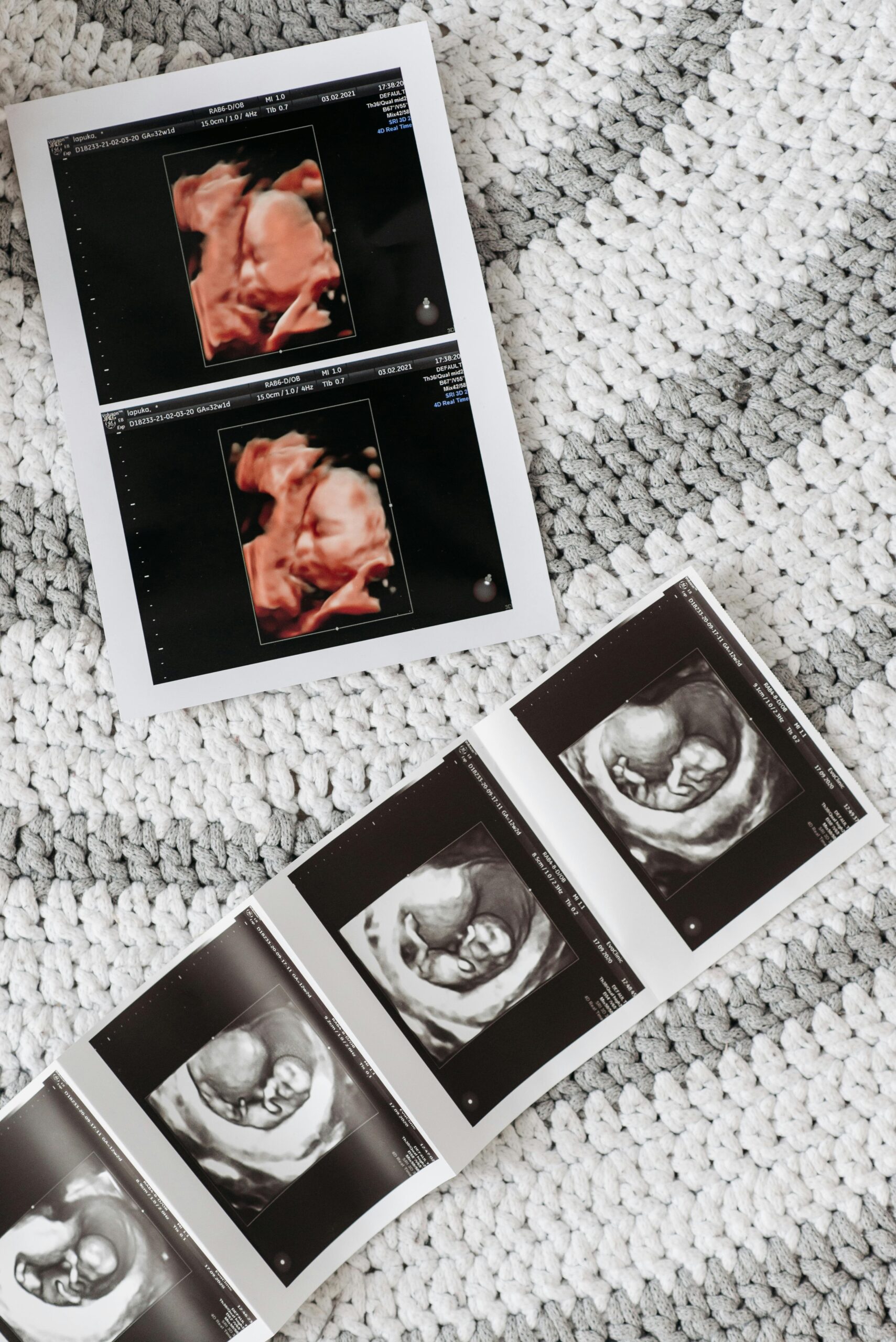 Fetus vs. Unborn: The Truth in Media Language - Save the Storks